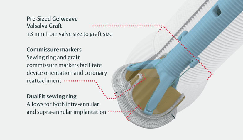KONECT RESILIA Aortic Valved Conduit | Edwards Lifesciences